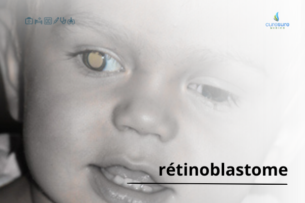 Understanding Retinoblastoma: Symptoms, Causes, Diagnosis, and ...