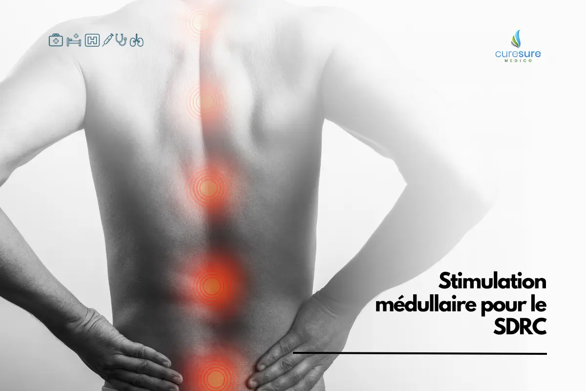 Stimulation de la Moelle Épinière pour Soulager la Douleur Chronique du SDRC