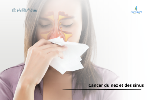Cancer du nez et des sinus : Symptômes, diagnostic, traitements et risques