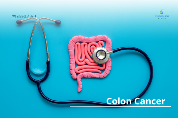 Access Advanced Colon Cancer Treatments in India: CureSureMedico for ...