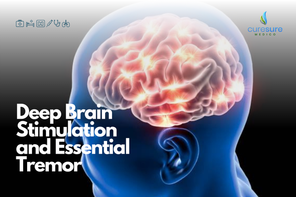 Deep Brain Stimulation and Essential Tremor