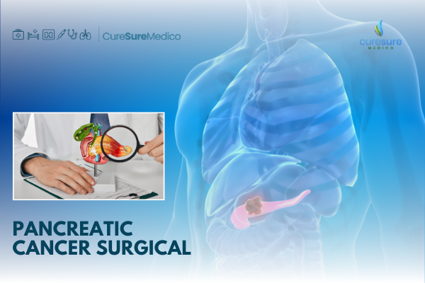 beating-pancreatic-cancer-surgical-approaches-and-postoperative-care