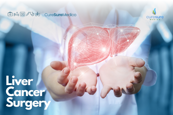 Liver Cancer Surgery: Connecting Hope and Cure with CureSureMedico