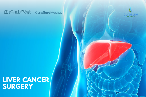 your-guide-to-liver-cancer-surgery-options,-procedures,-and-care